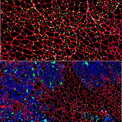 Mouse model of Duchenne muscular dystrophy (DMD) developed