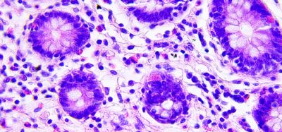 modern-microscopy-in-cancer-research