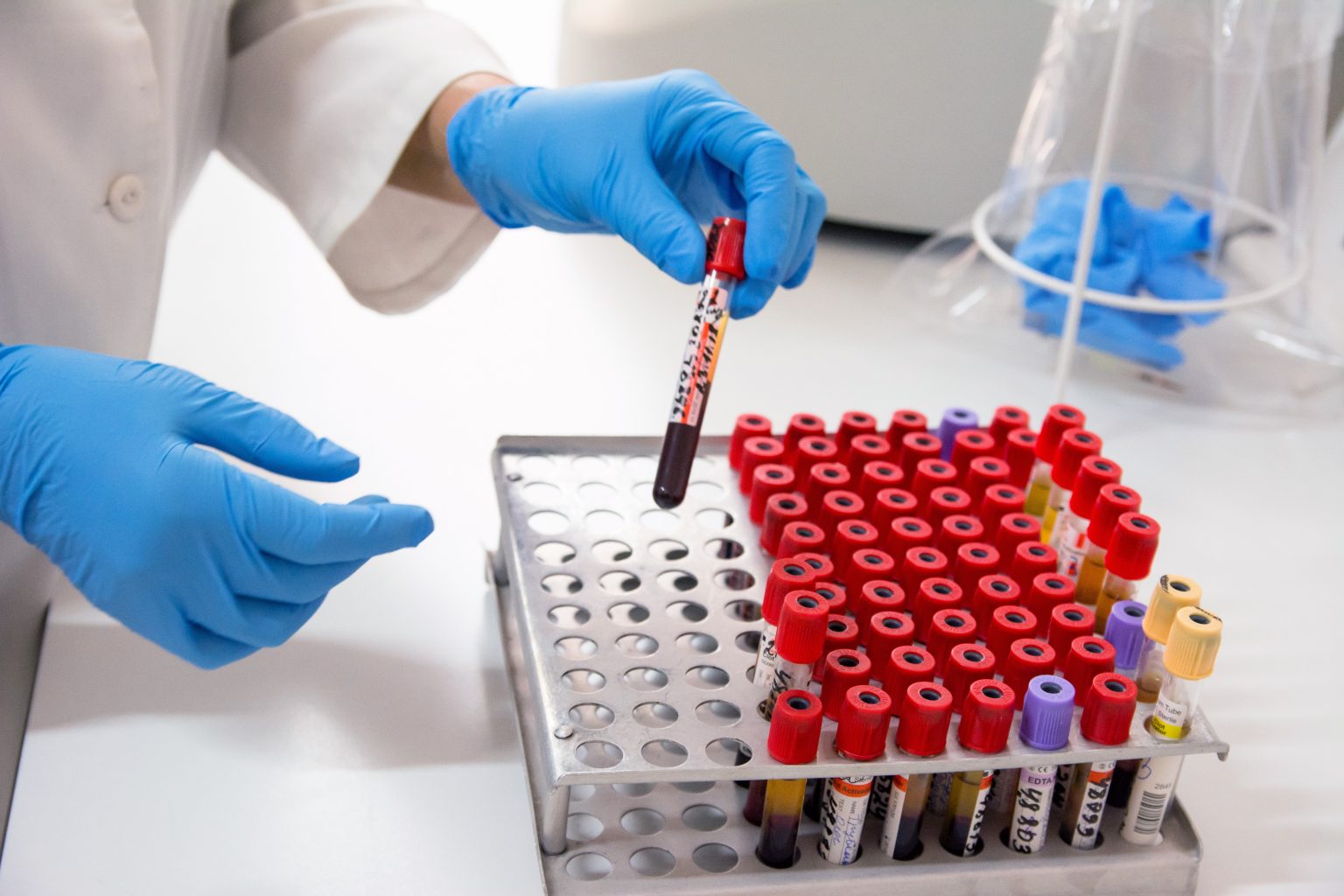 Progression, trends and industry leaders in HIV and AIDS research