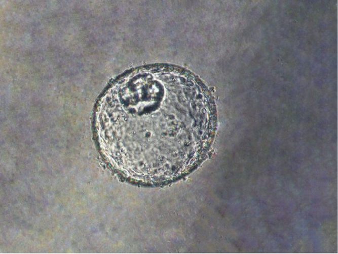 Novel organoid model for gastroesophageal junction cancer