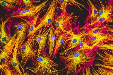 AI advancing drug discovery: the future is multi-cellular studies