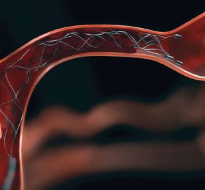 Brainomix - News, Articles, Whitepapers - Drug Target Review