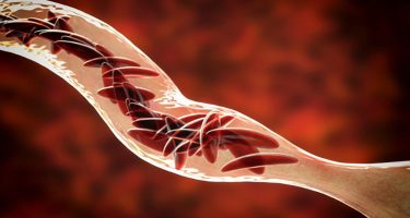 New cryo-EM method reveals insight into blood disorders