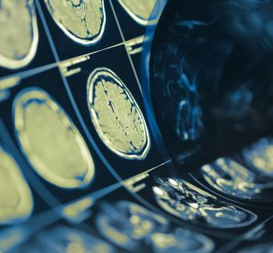 Dr Martin Pomper - News, Articles, Whitepapers - Drug Target Review