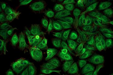 New tools accurately illuminates intracellular phase separation