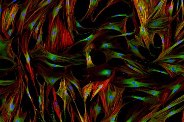 Self-aligning single-molecule microscope achieves unrivalled resolution