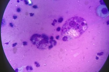 Macrophage phenotype insights could improve immunotherapy