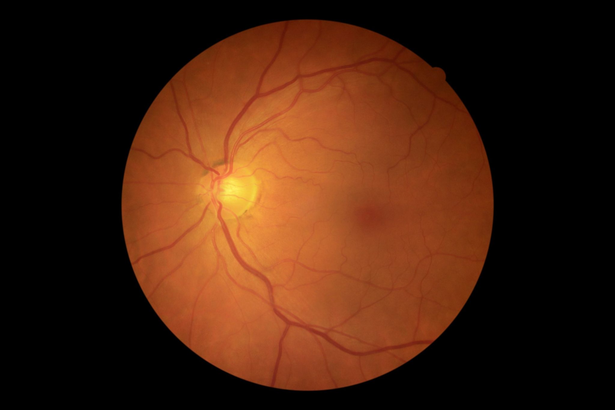 Functional retinal organoids improve drug testing for eye disease ...