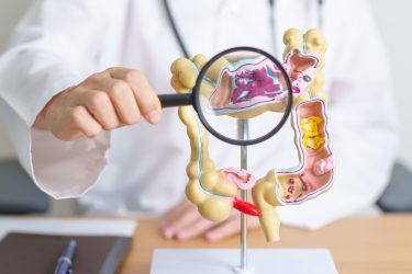 New drug combo targets colorectal cancer mutation - Drug Target Review