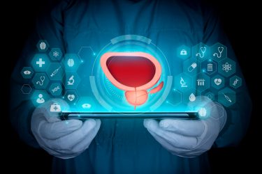 New AI model may enable more targeted prostate cancer treatment