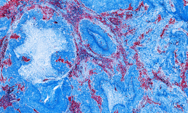 Study reveals cancer cell fuelling mechanism