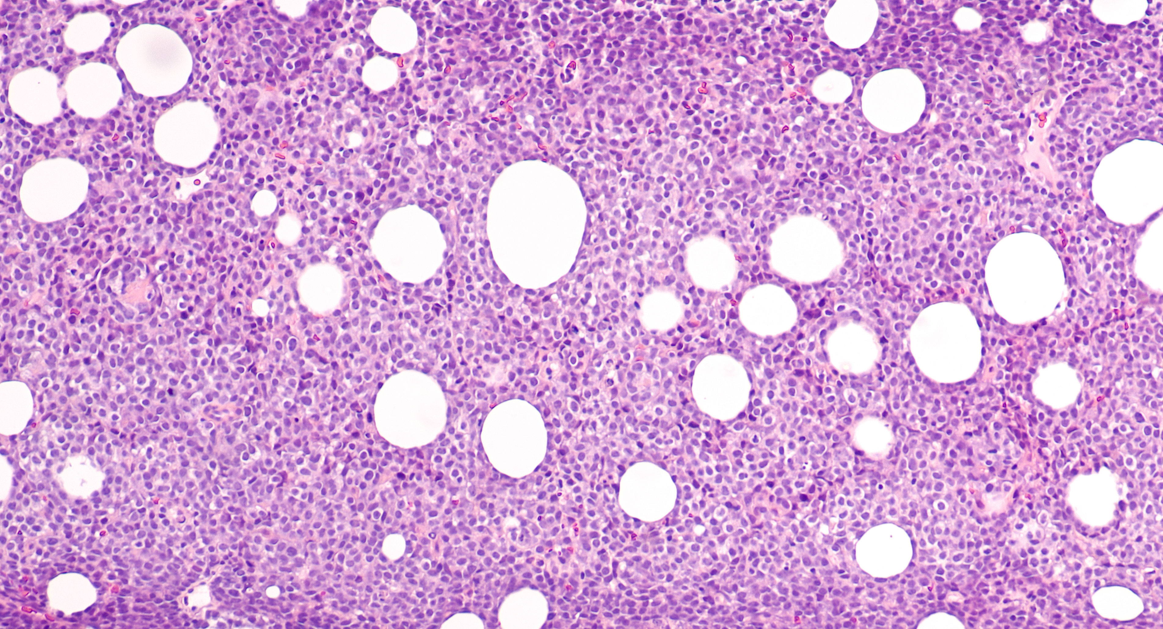 Harnessing the power of genomic sequencing augments diagnosis and ...